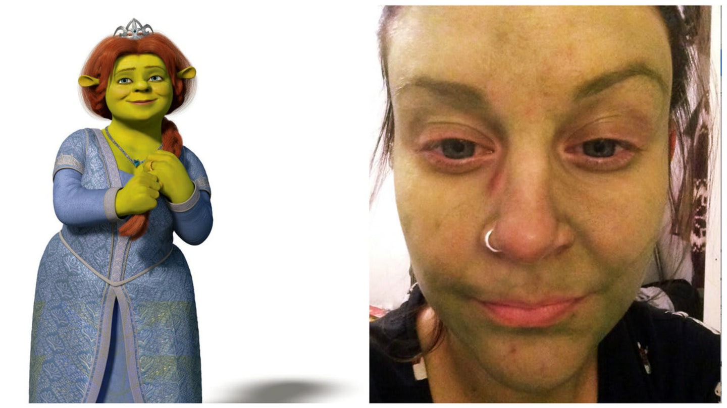 FOTO: Chtěla být opálená, místo toho vypadá jak Fiona ze Shreka ...